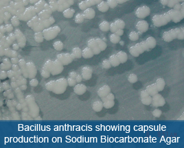 Public Health & Environmental Laboratories | Bacillus anthracis